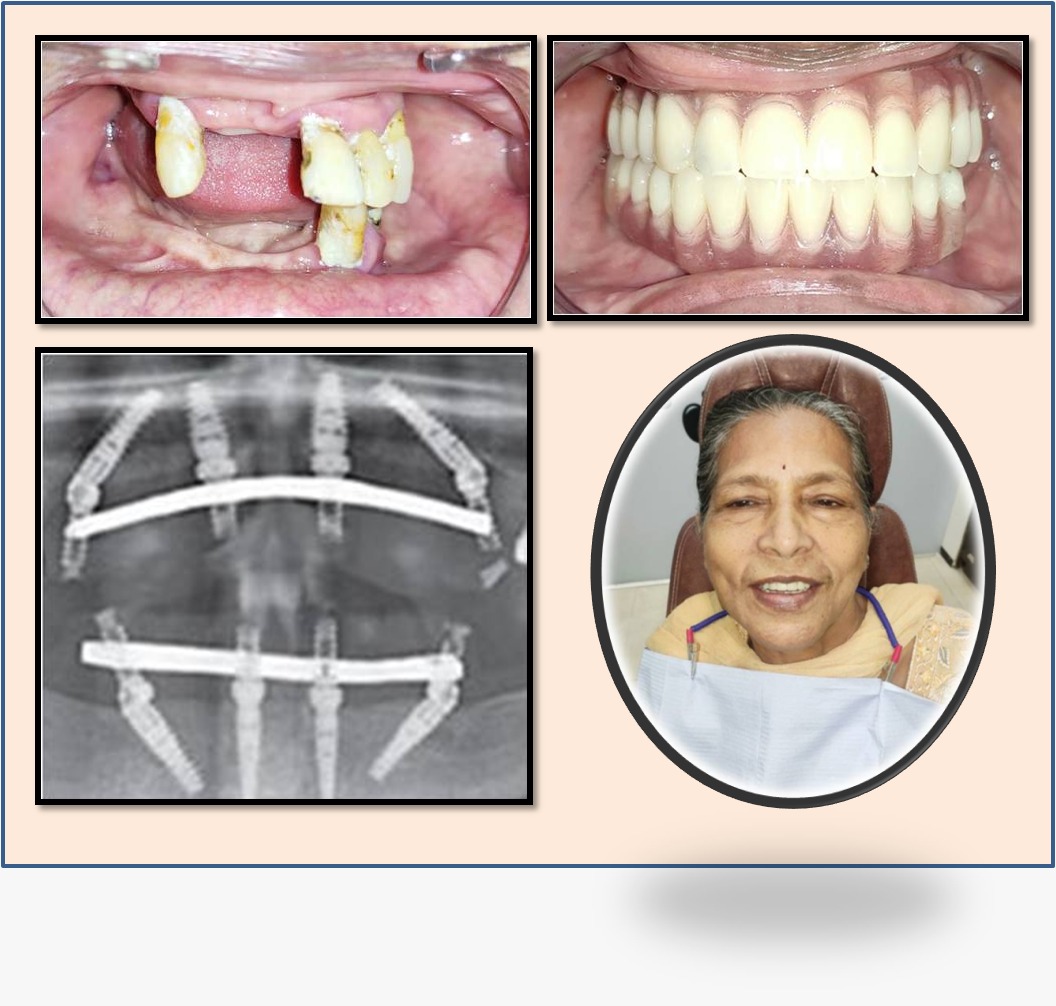 Patient Gallery – Dental Designs